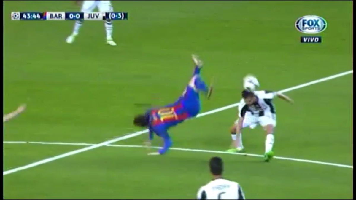 La gran caída de Lionel Messi que le provocó una herida en la cara ...